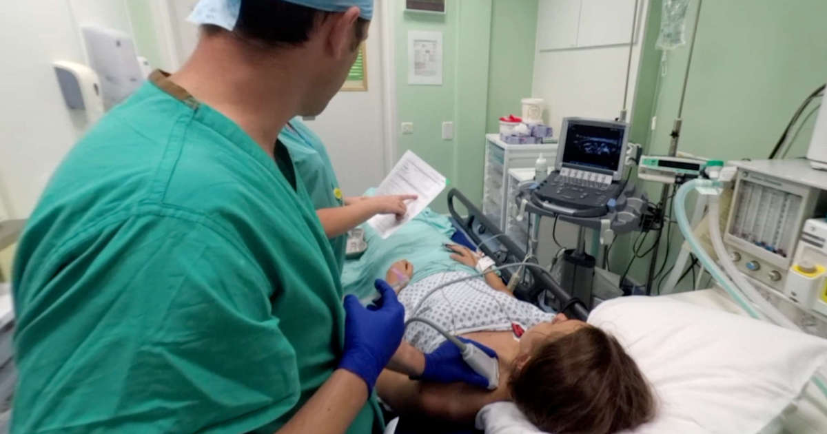 Stop Before You Block: ExR